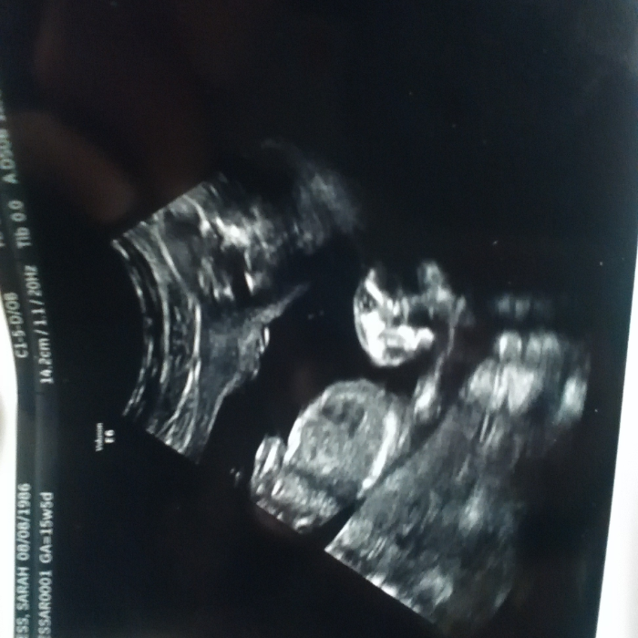 New Mom To Be Striving For A Fresh Start In Life by Sarah Hess - Indiegogo
