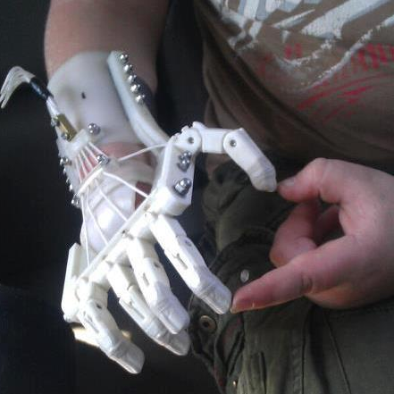 Robohand by Richard Van As - Indiegogo