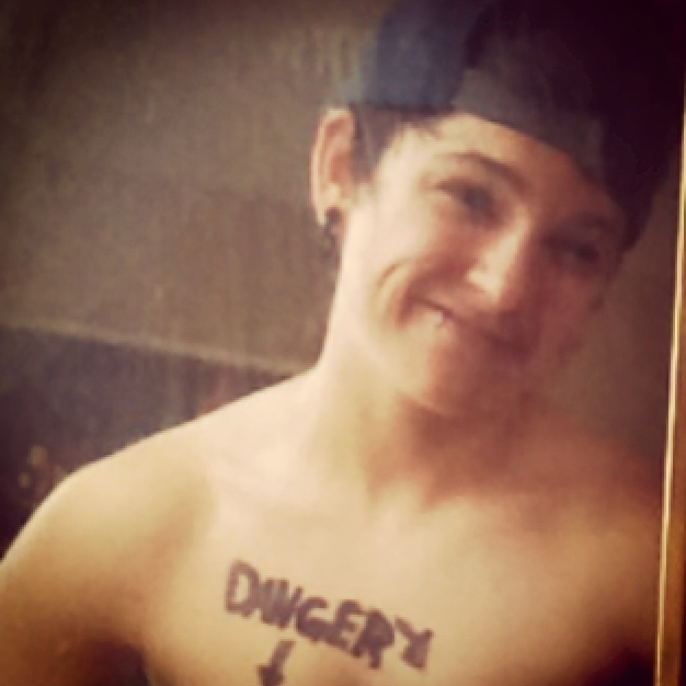The Best Chest Fest - FTM Top Surgery by Jordan Pepper - Indiegogo