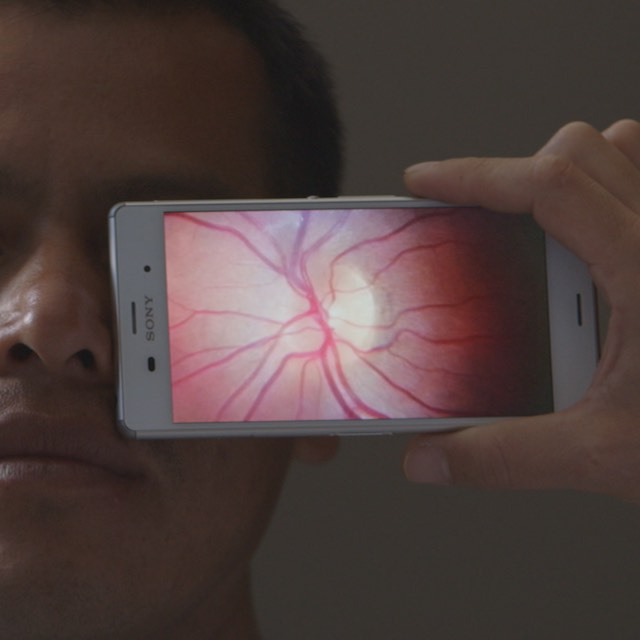 Peek Retina: Help Fight Avoidable Blindness by Andrew Bastawrous ...